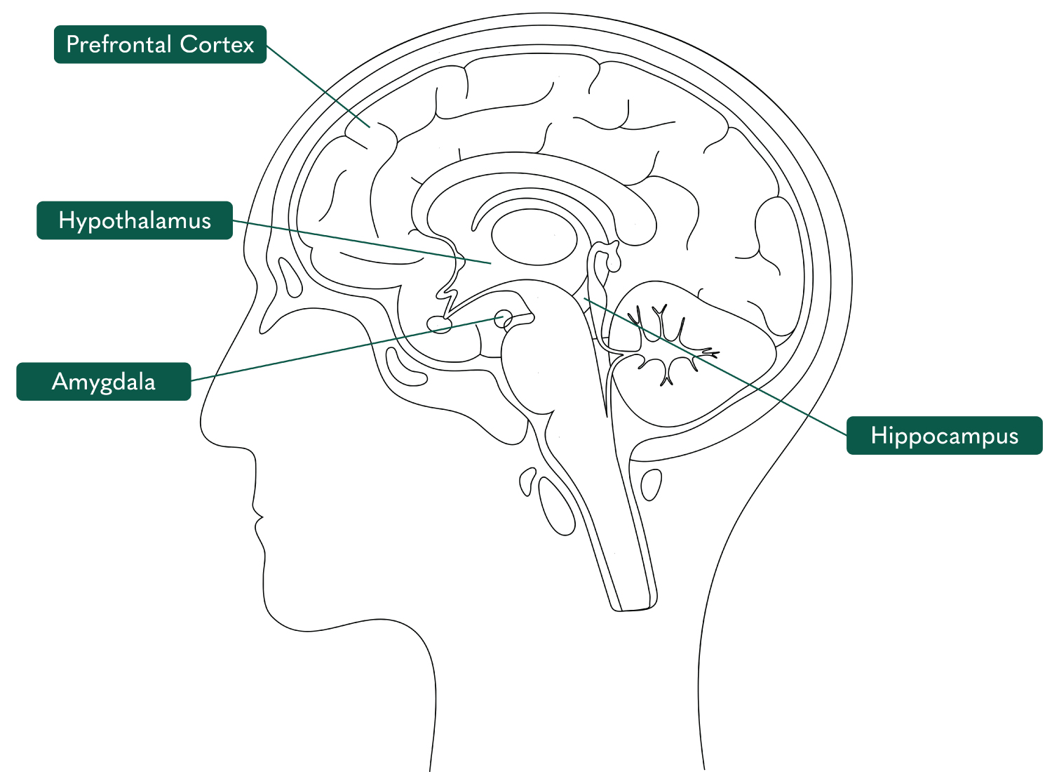 Post Traumatic Stress Disorder Sleep Disturbances And Biomarkers Post Traumatic Stress Disorder Sleep Disturbances And Biomarkers